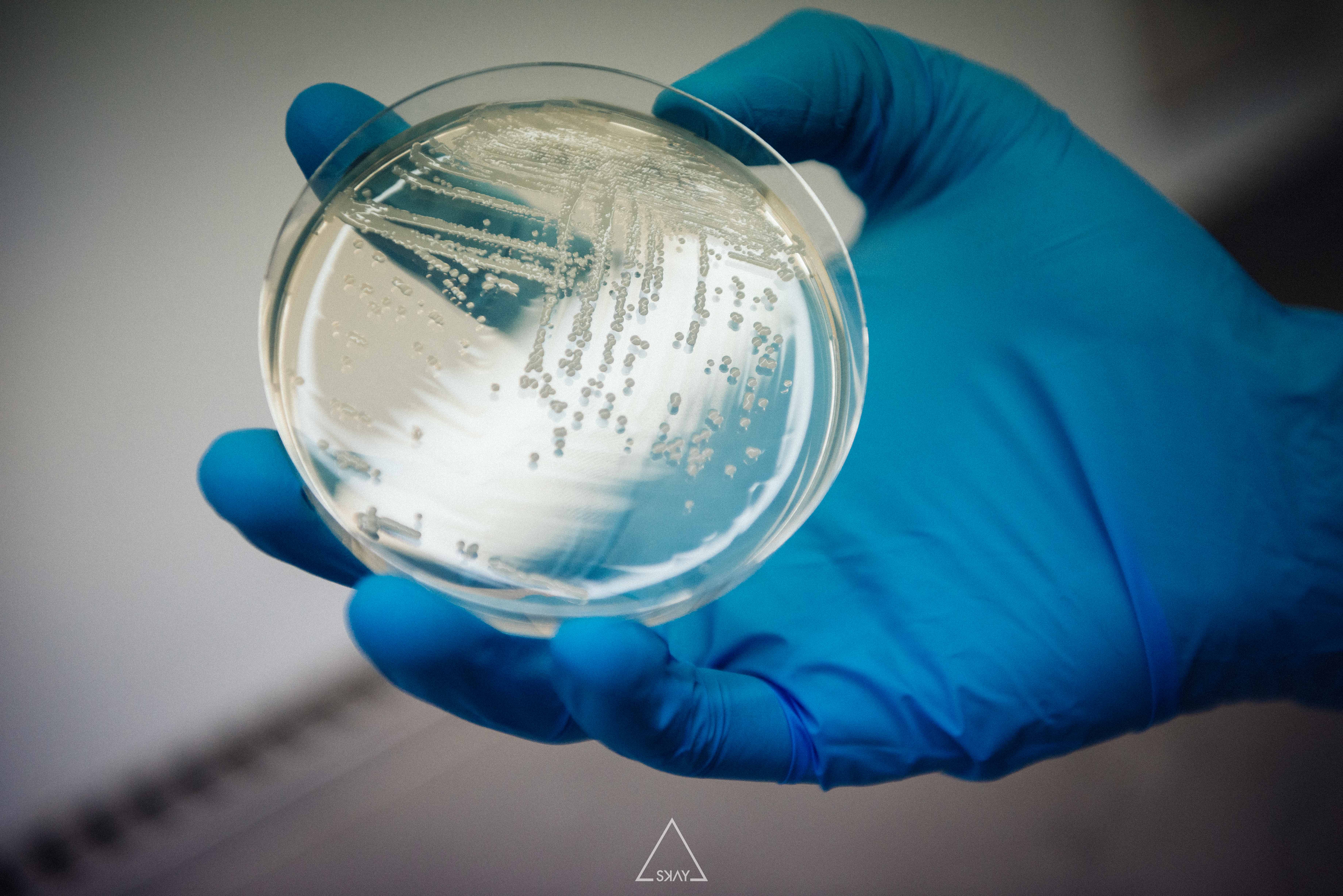 A new and unique research-oriented Master in Molecular Microbiology at ...